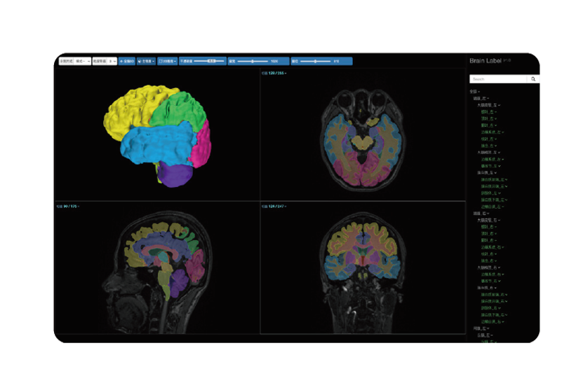 Atlas pre-selection strategies to enhance the efficiency and accuracy of multi-atlas brain ...
