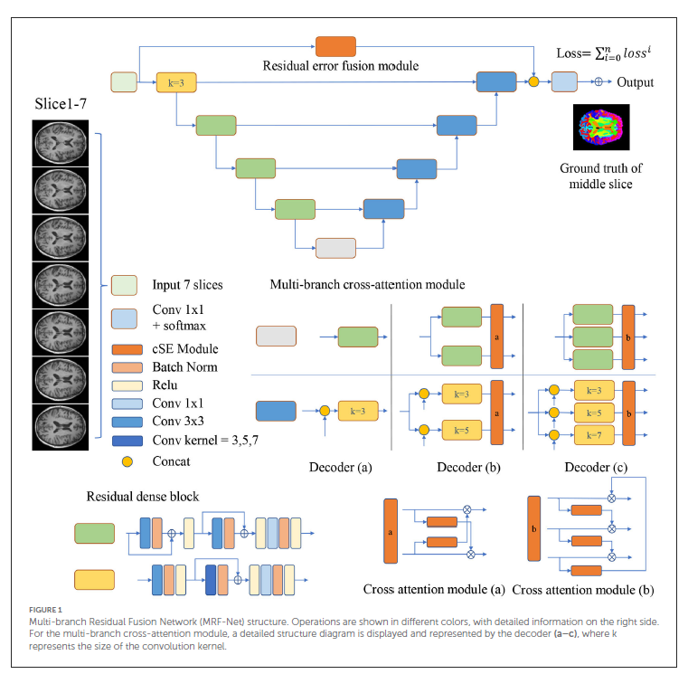 MRF-Net: A multi-branch residual fusion network for fast and accurate whole-brain MRI ...